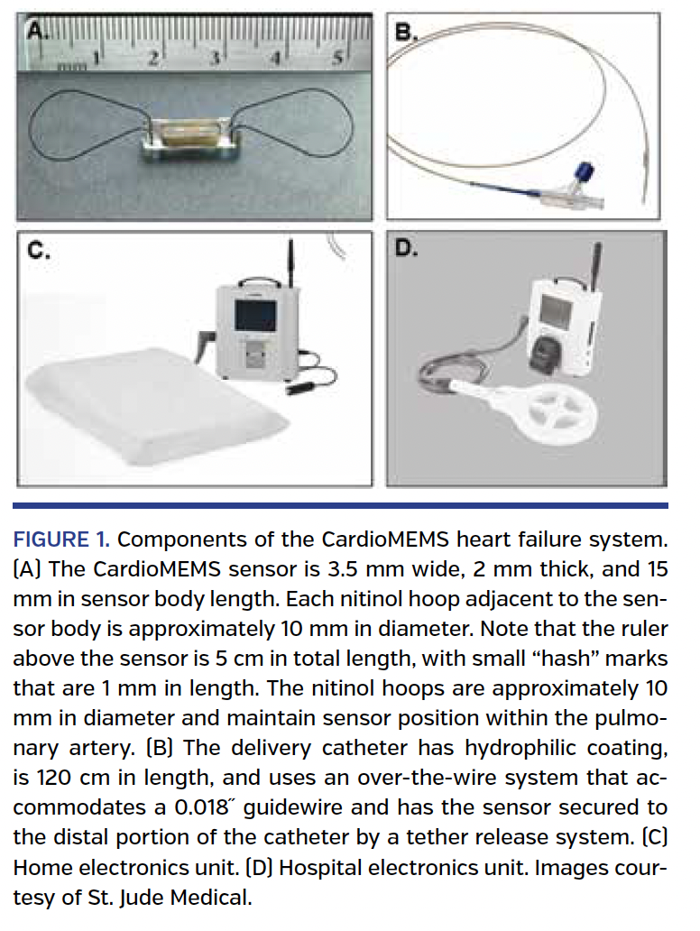 The CardioMEMS Heart Failure Sensor A Procedural Guide For Implanting